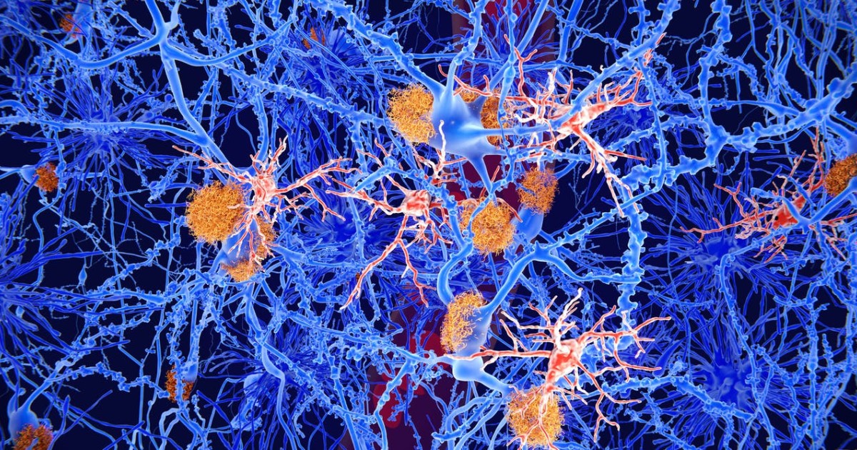 Immune cells in the brain play key role in relationship between gut ...