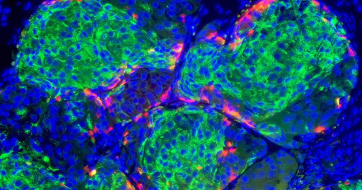 Focus on beta cells instead of immune system could be key to preventing ...