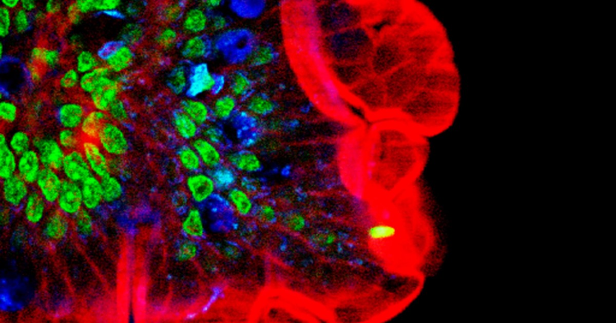 Researchers identify critical gene in regeneration of intestinal lining ...